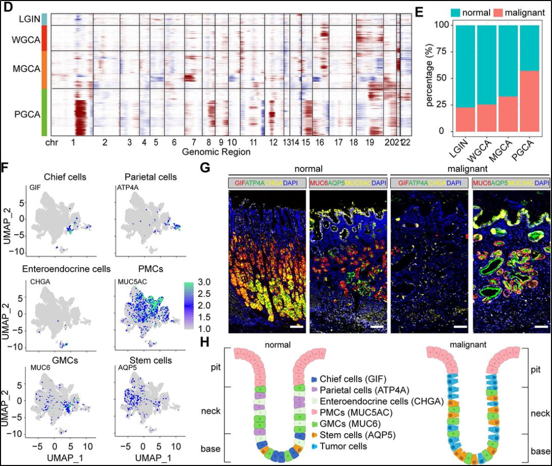 IF=31.793 | scRNA-seq联合CUT&Tag揭示NNMT富集AQP5+肿瘤干细胞驱动早期胃贲门腺癌恶性进展 - 单细胞测序网