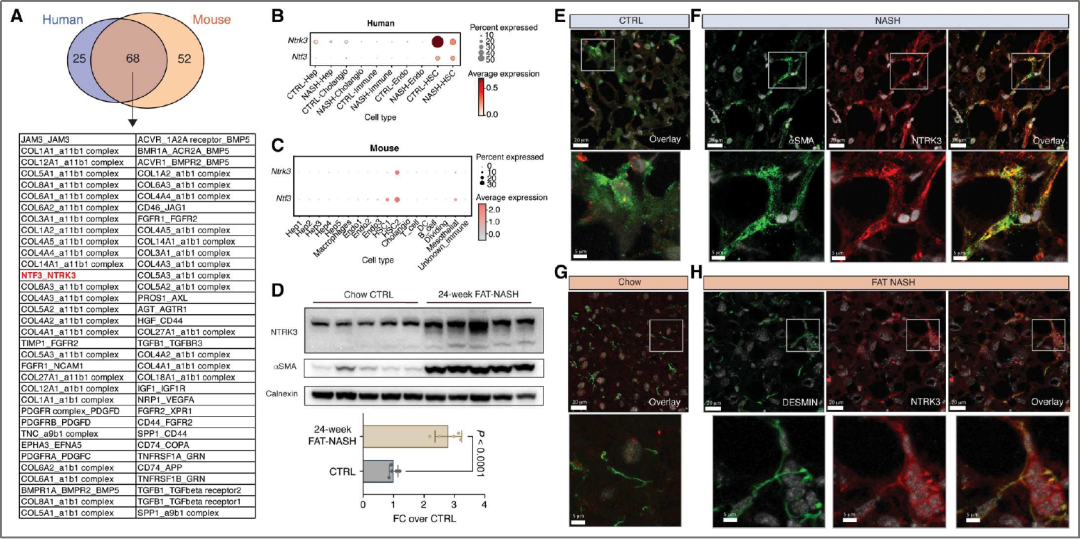 高分热点文章 | NAFLD/NASH进展关键机制和新型治疗靶点的研究 - 单细胞测序网